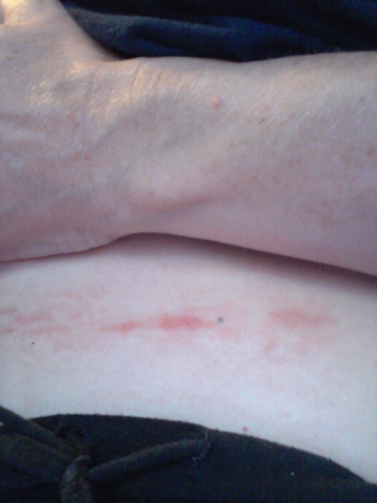 Patty's Learning to Run!: Breast Chafing With Running. Ouch!