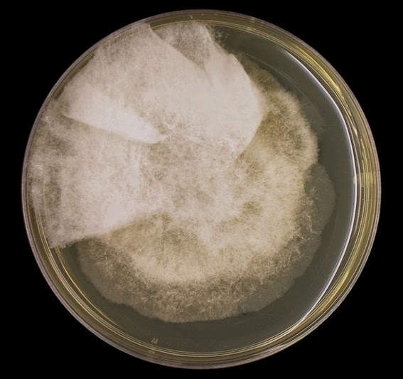 Fun With Microbiology (What's Buggin' You?): Apophysomyces elegans ...