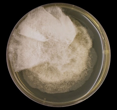 Fun With Microbiology (What's Buggin' You?): Apophysomyces elegans ...