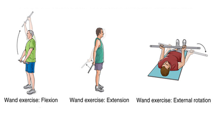 What Is Frozen Shoulder ?: Frozen Shoulder Exercises
