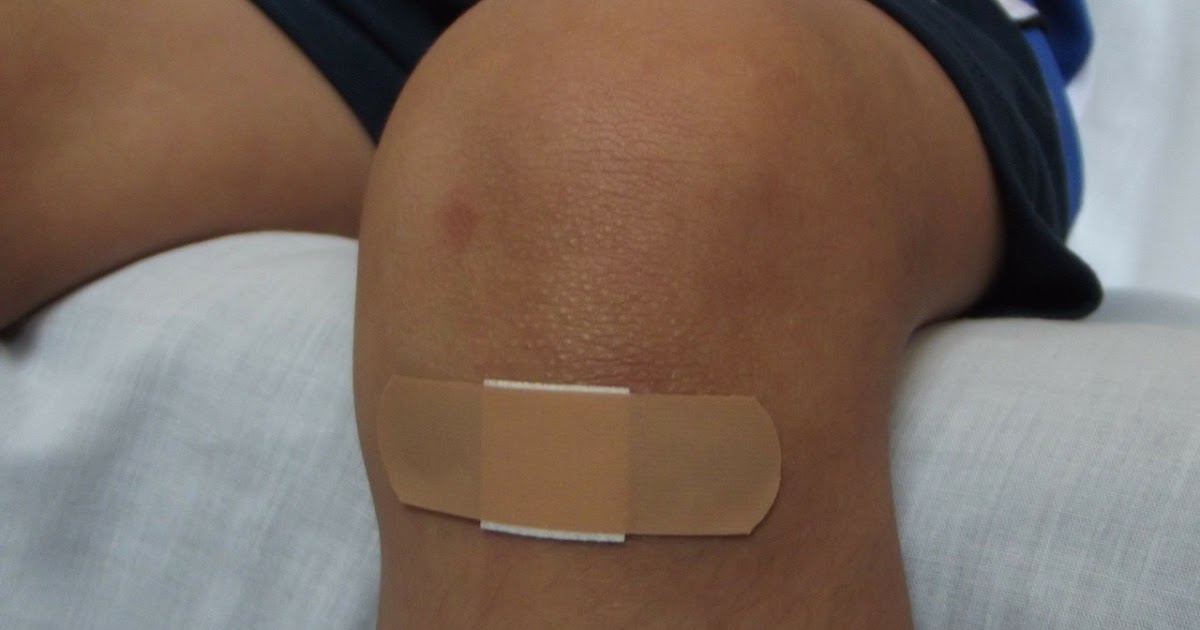 Inovasi Plester Terbaru dari Hansaplast untuk Perekat Luka Ringan