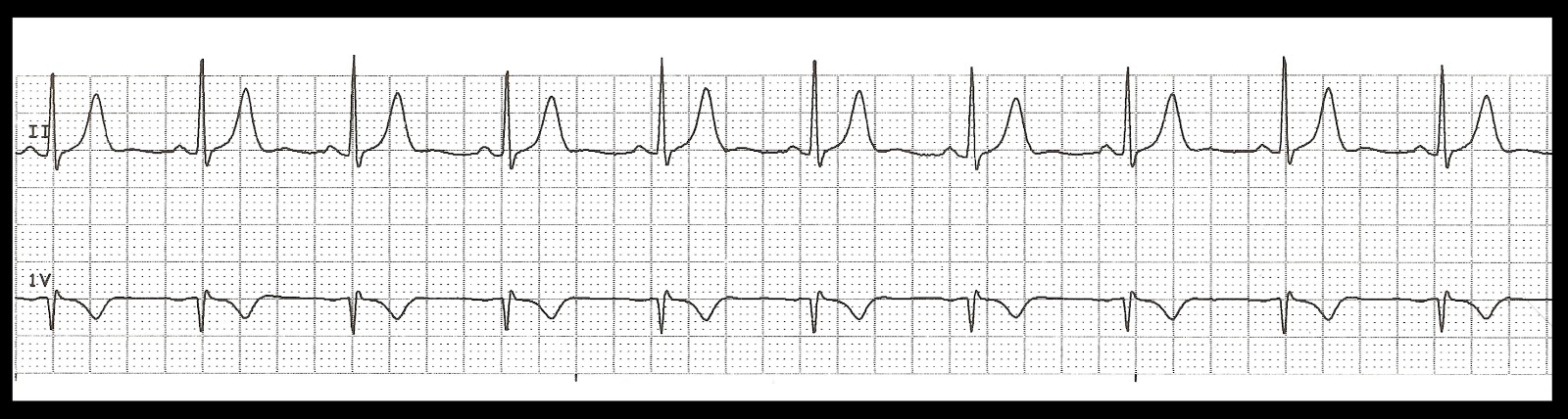 Practice EKG Strips