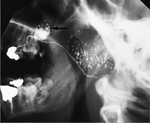 Dentistry and Medicine: Anatomy and Physiology of the Salivary Glands ...