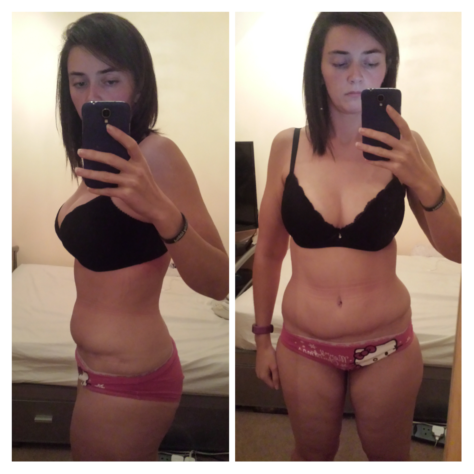 Laura Fat To Fit Surgery Quick Update 7 Month Post Op laura-fat-to-fit-surgery-quick-update-7-month-post-op