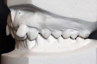 Orthodontics: UG Model Analysis Position of teeth