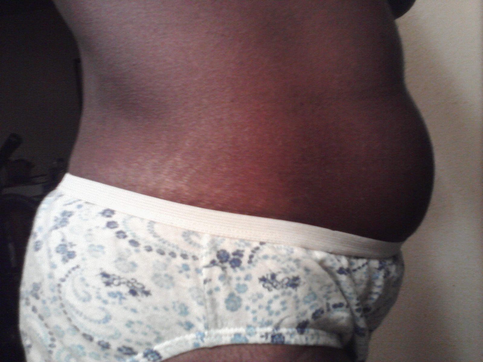 How I Am Shrinking My Fibroids Pictures Of Shrinking Fibroids Then how-i-am-shrinking-my-fibroids-pictures-of-shrinking-fibroids-then