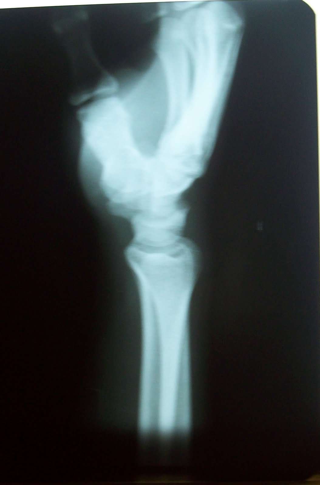 Rx011: Proyecciones Muñeca