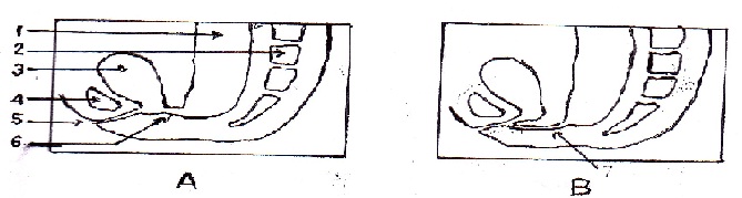 Dr Herry Setya Yudha Utama SpB. FInaCS. MHKes. ICS: ATRESIA ANI DAN ...