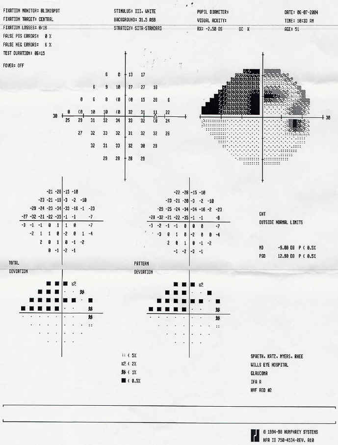 Study finds benefit of comprehensive eye exam and retinal photography ...