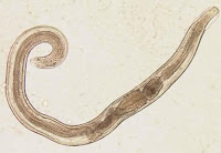 Ciri-Ciri cacing Enterobius vermicularis | Intisains