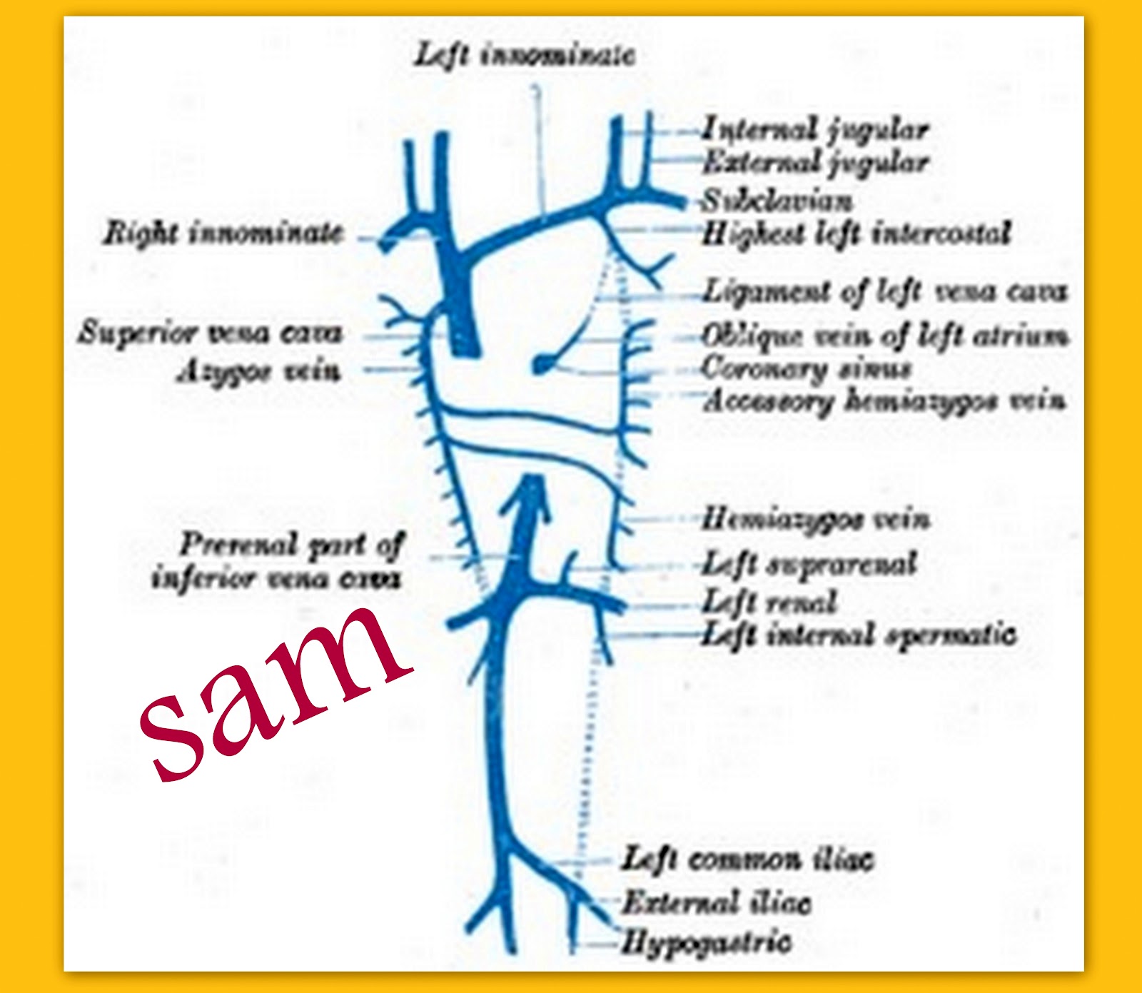 la Sclerosi multipla .. Ccsvi vista da SAM, e NON solo: La vena