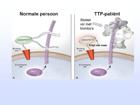 TTP - Trombotische Trombocytopenische Purpura : Wat is TTP.