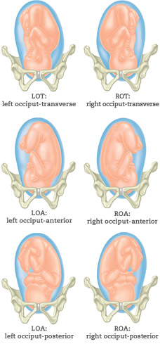 Wombmama's UnaBirth Blog : What's going on..