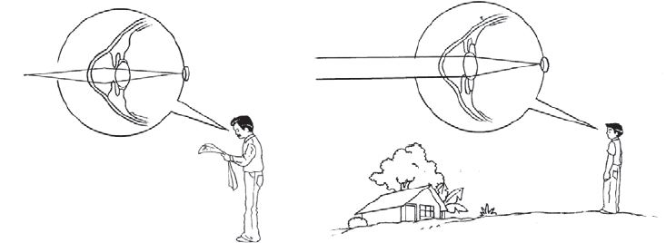 Alat Optik Mata Dan Kacamata Serta Prosedur Proses Melihat Pada Mata ...