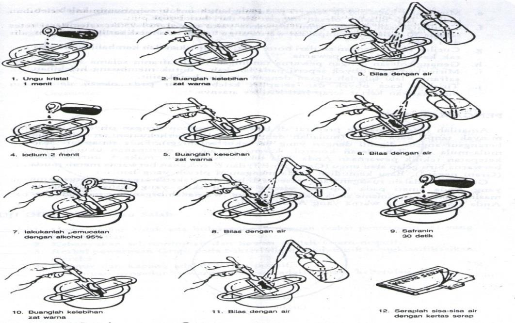 Teknik Pengecatan / Pewarnaan Bakteri - Dunia Kimia