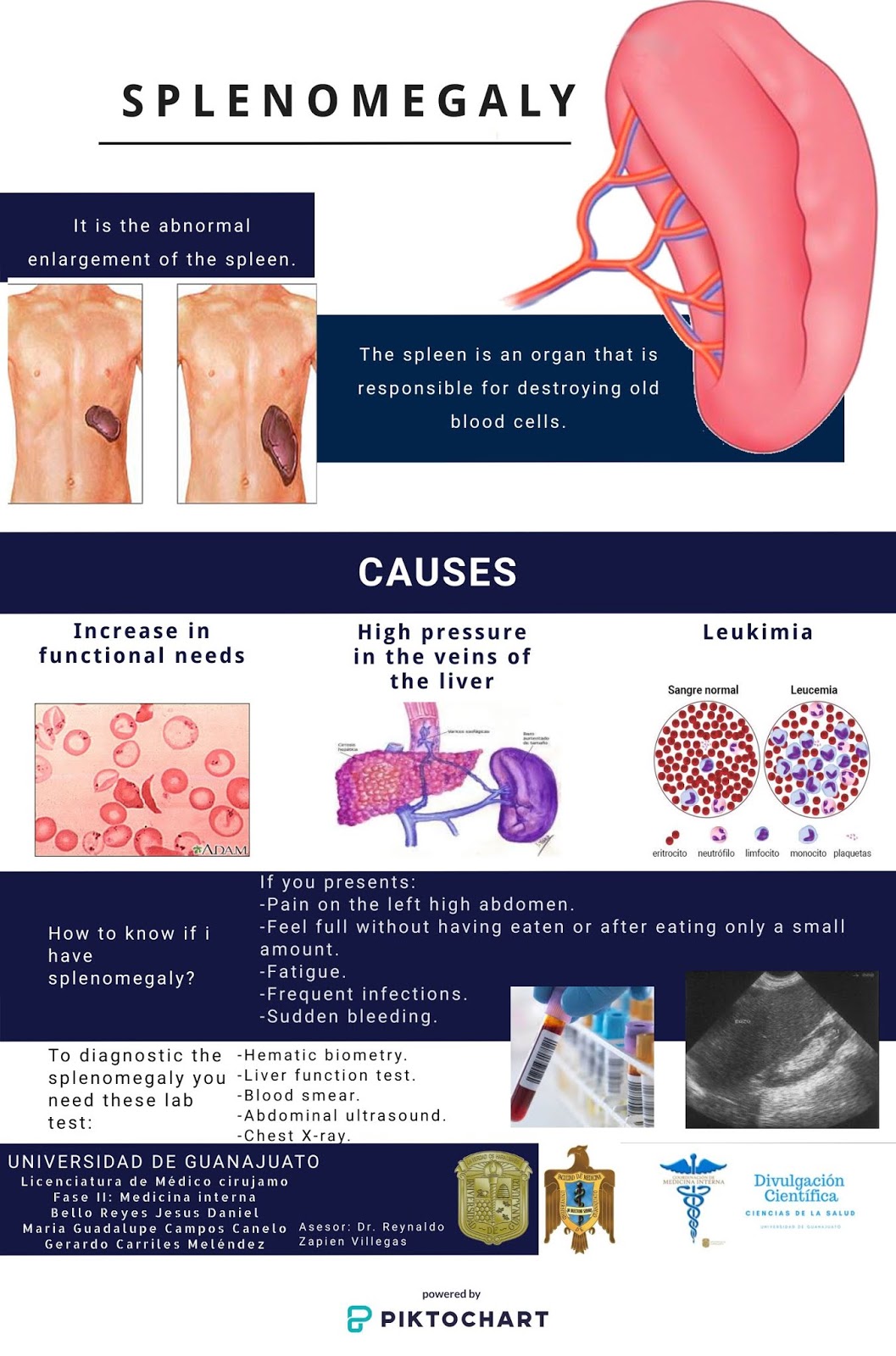 DIVULGACIÓN CIENTÍFICA UG: Esplenomegalia