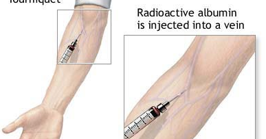 PEMBERIAN OBAT INTRAVENA | SUKSES