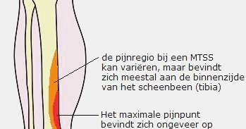 Scheenbeenklachten
