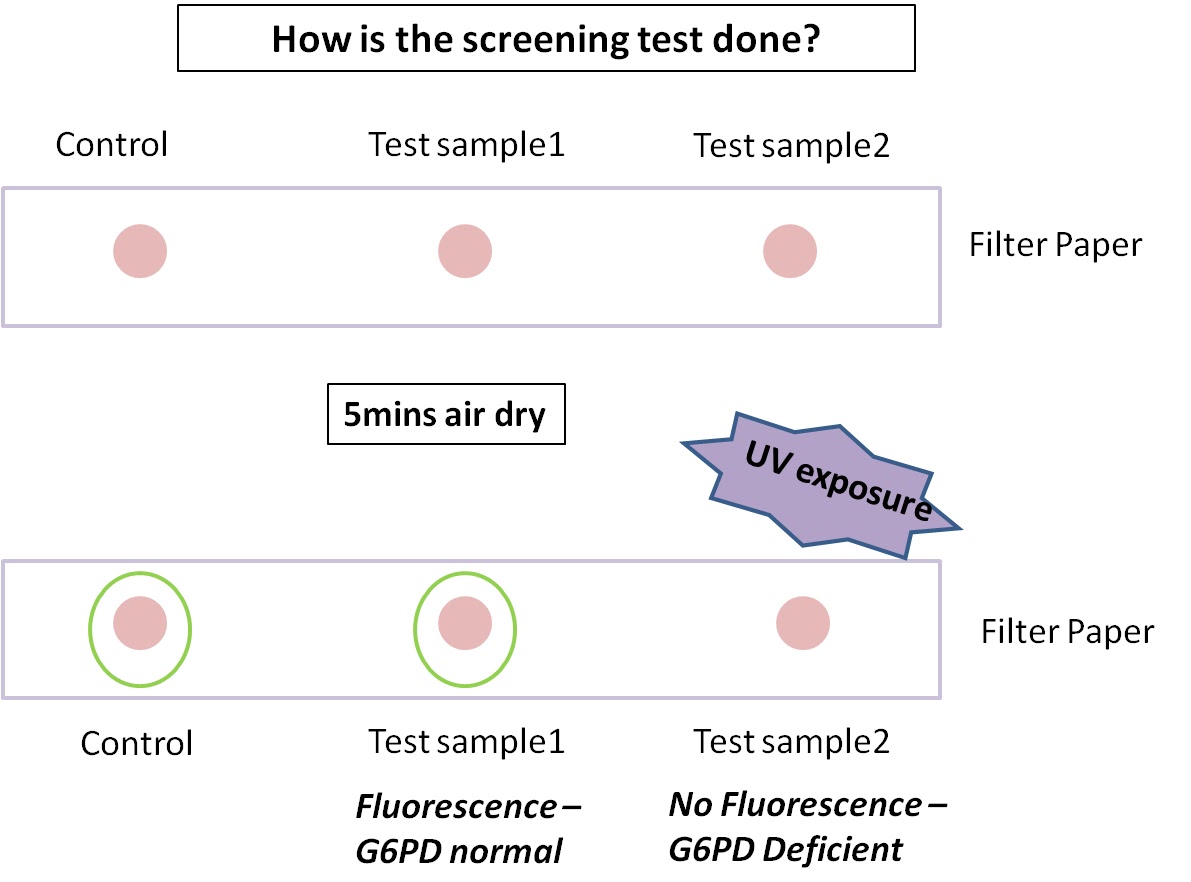 Genetic Awareness Program on Glucose 6 Phosphate Dehydrogenase ...