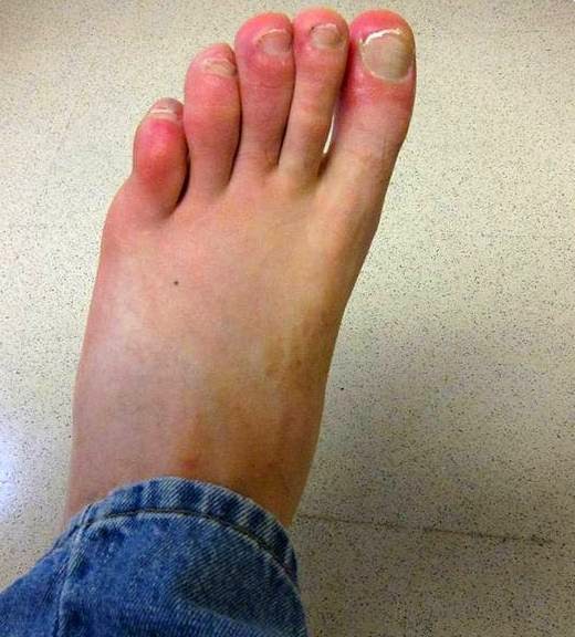 MEC&F Expert Engineers : OF THE 28,000 PEOPLE HYPOTHERMIA KILLS YEARLY ...