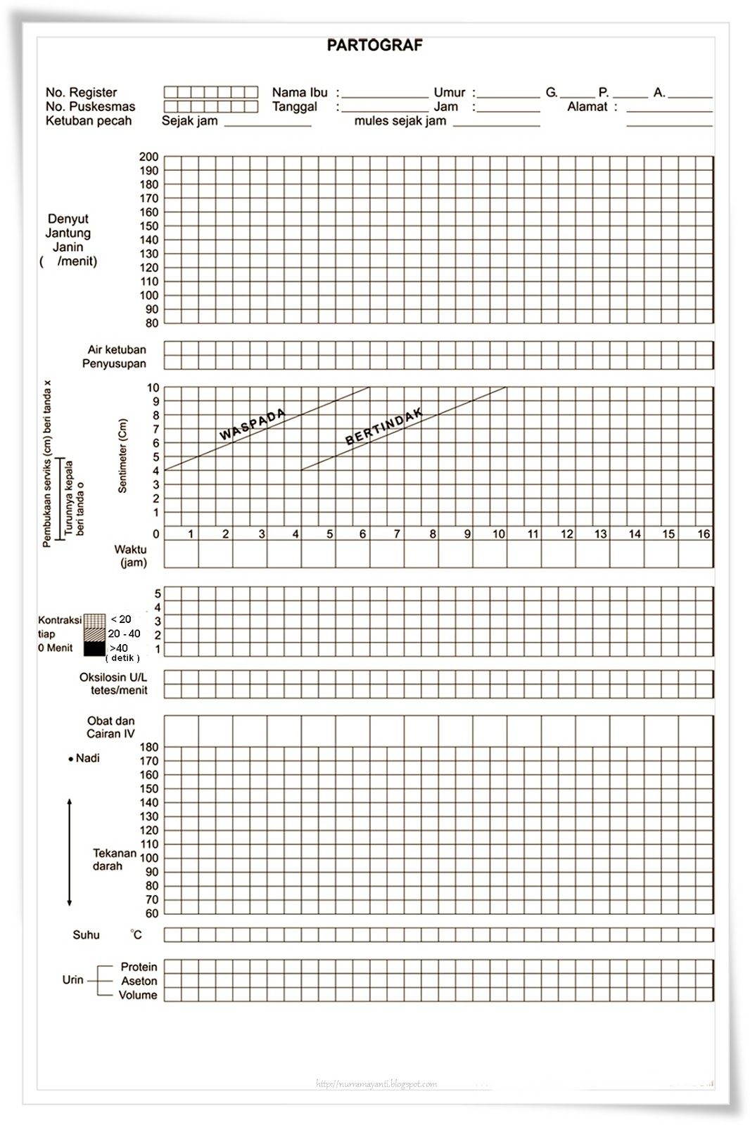 CATATANKU HARI INI: PARTOGRAF