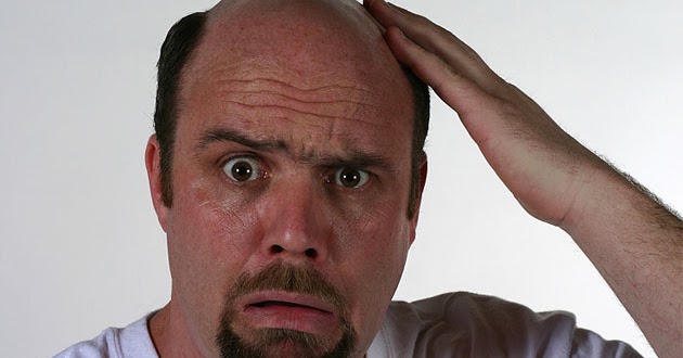 Signs You're Going Bald. - Lifestyle+