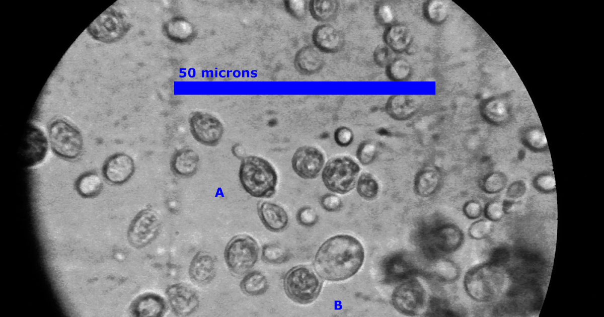 Brewers Yeast Microscope