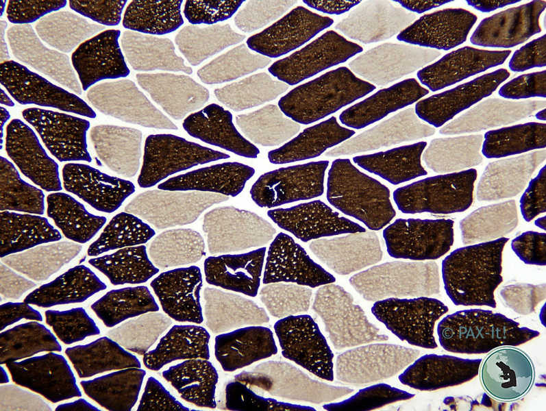 Microscope World Blog: Muscle under the Microscope
