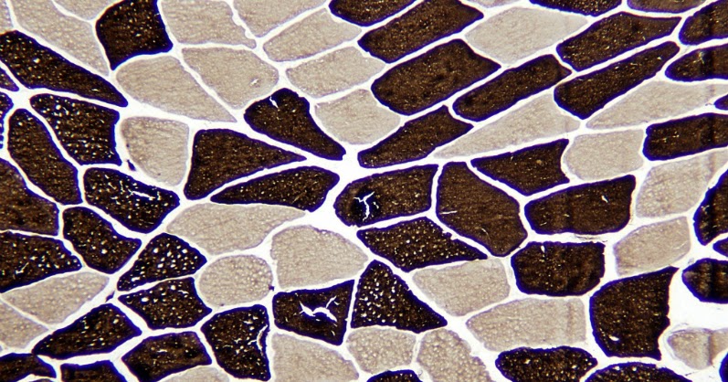 Microscope World Blog: Muscle under the Microscope