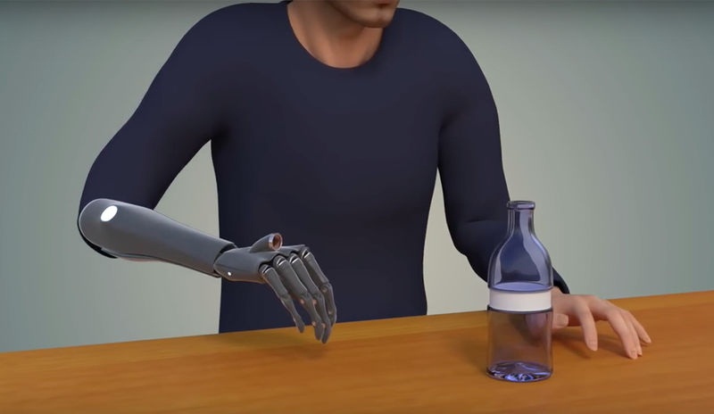 Tecnoneo: Innovadora prótesis de mano inteligente que ejecuta ...