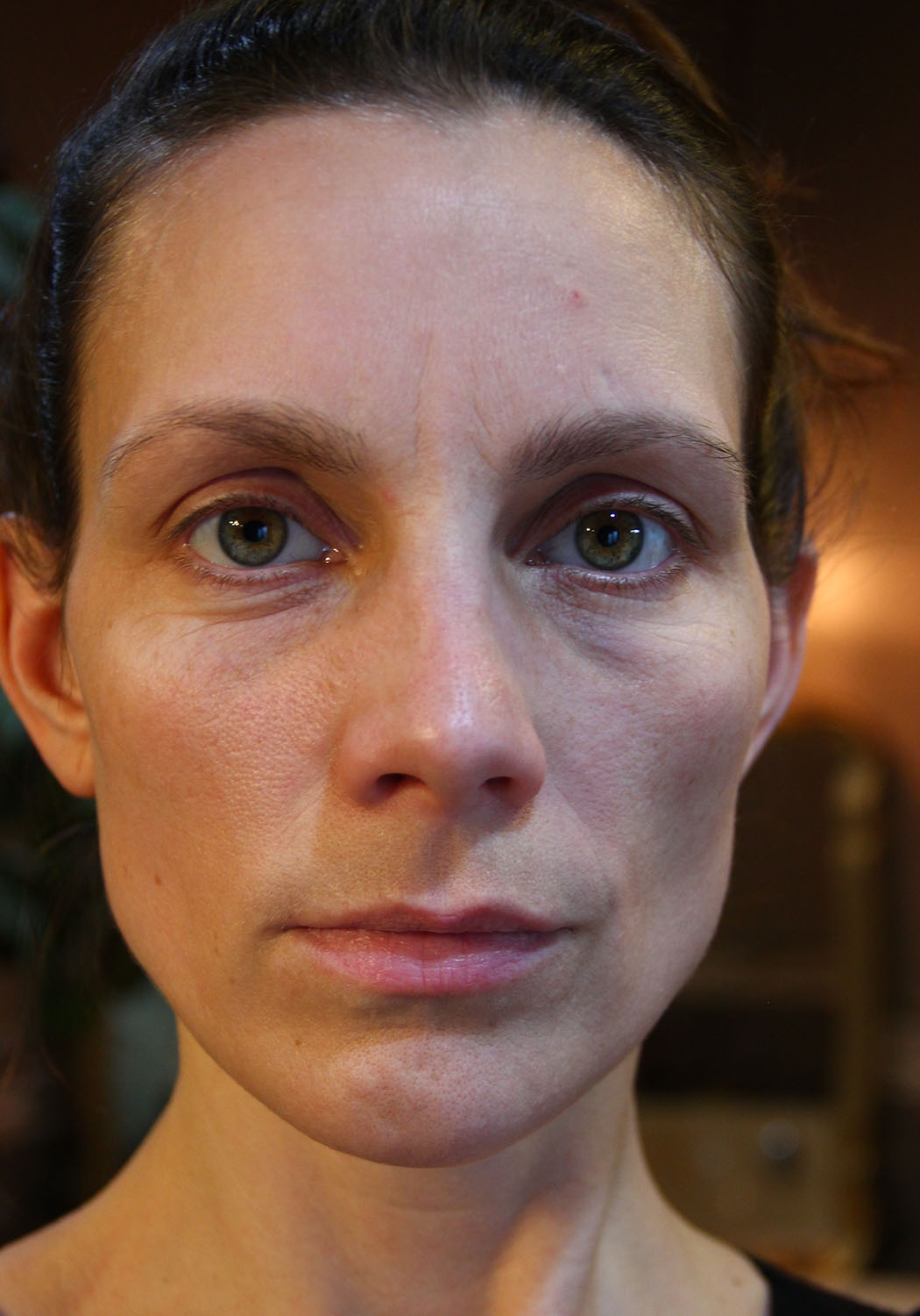 Tria Beauty - SmoothBeauty Laser Review