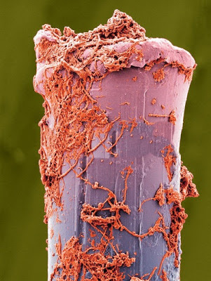 web pro scientist: Used toothbrush under electron microscope