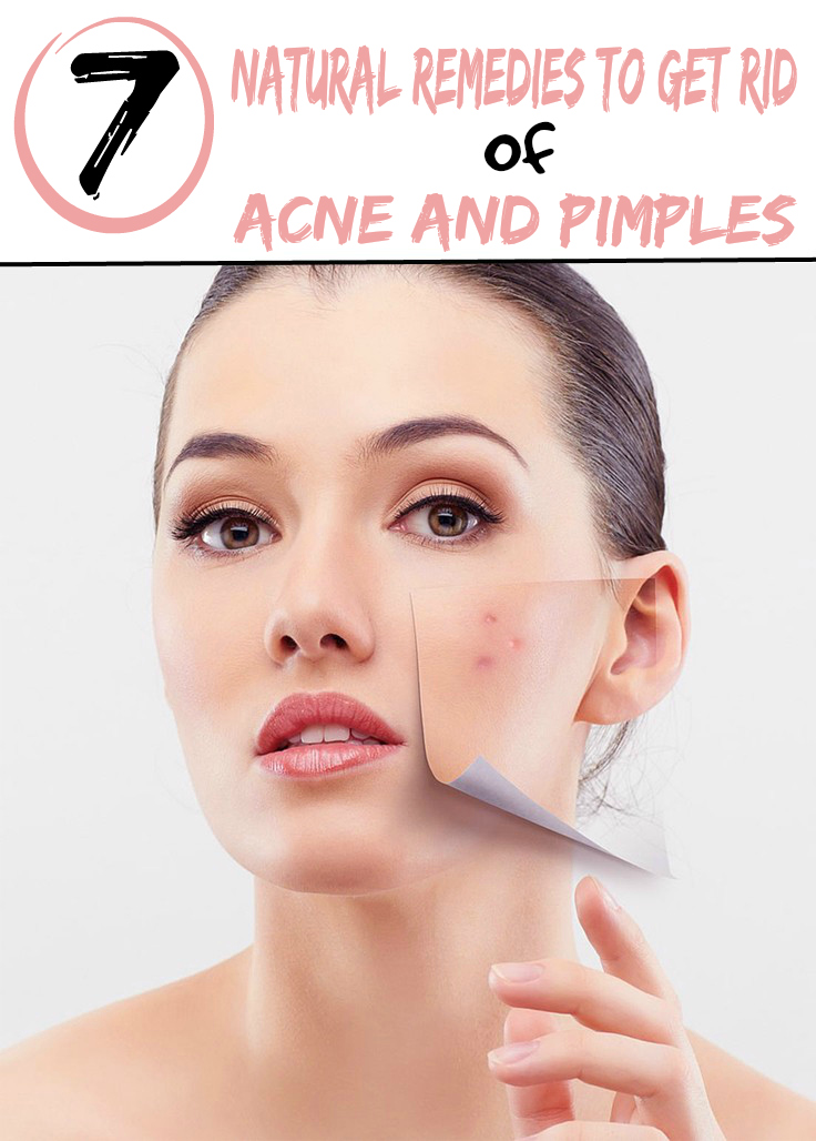 7 Natural remedies to get rid of acne and pimples - Healthamania