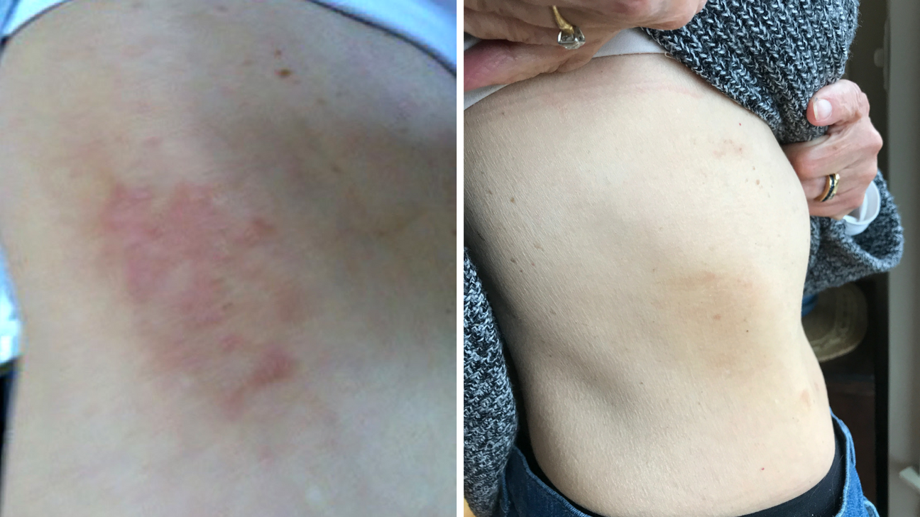 CBD for the Treatment of Skin Sicknesses