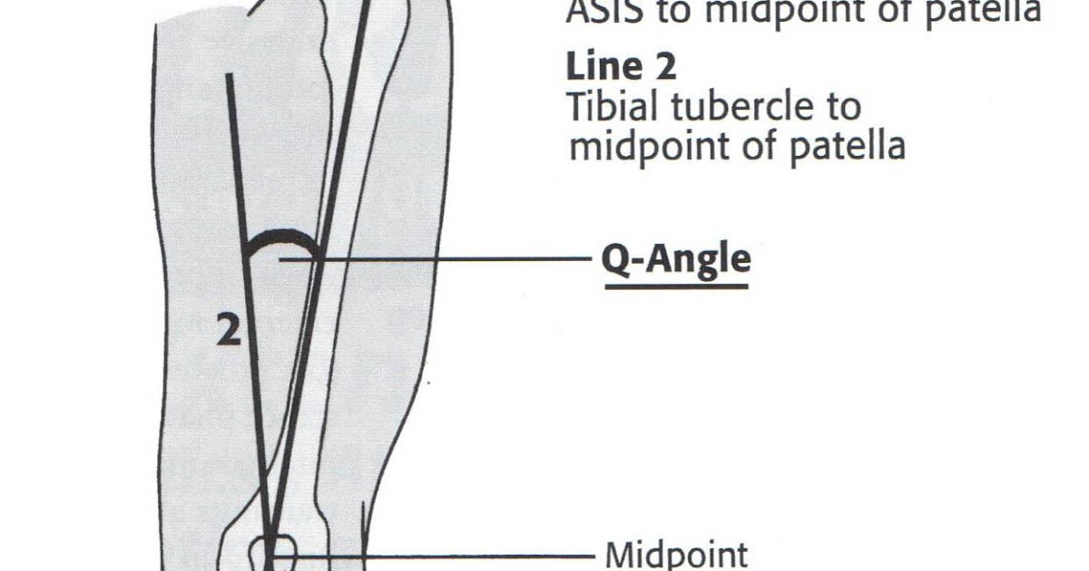 陳立人- 舒迷車坊: 再論 Q Angle，你的力學學到哪裡去了？