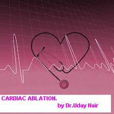 COCHIN CARDIAC CLUB: CARDIAC ABLATION.