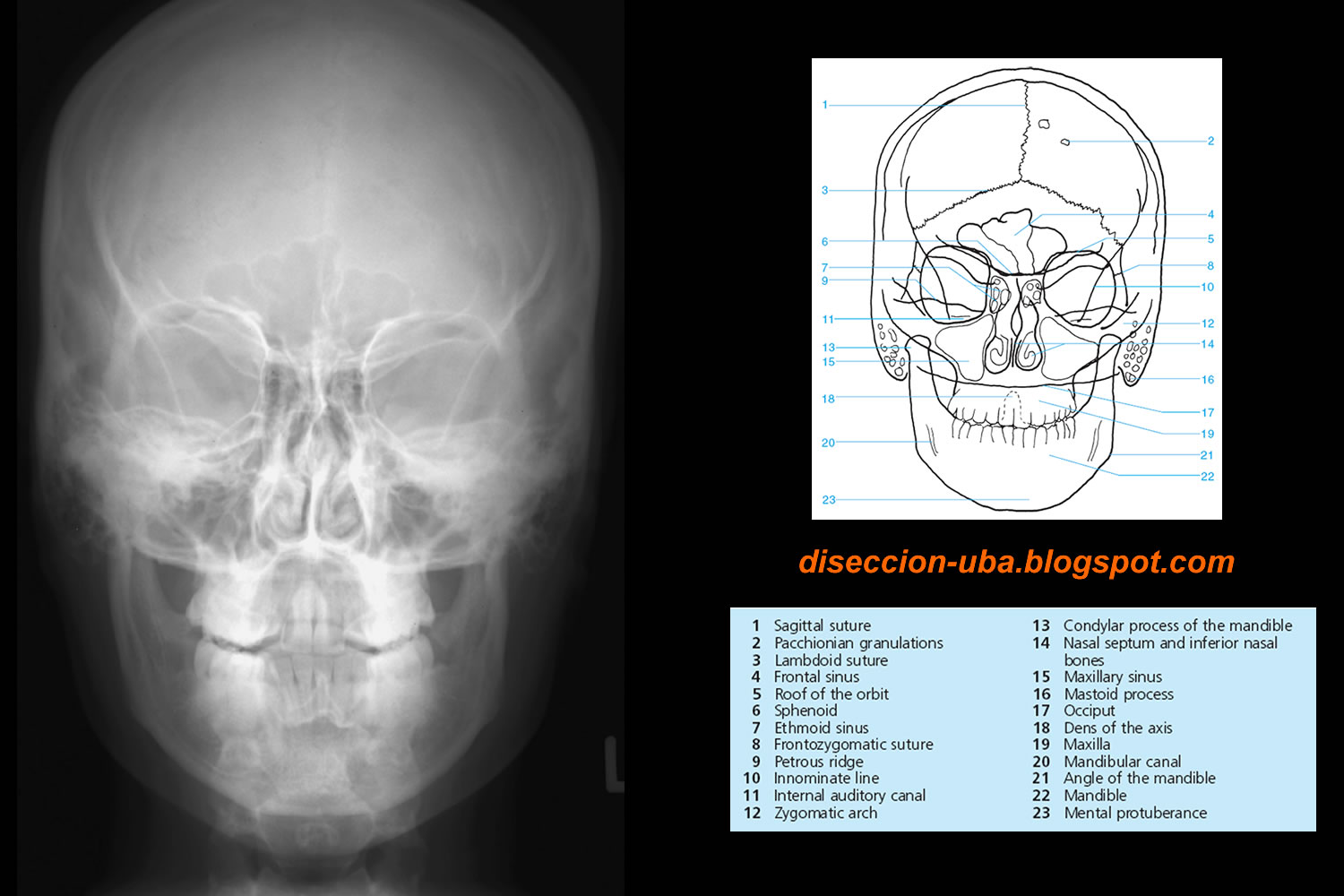 rx: Rx cráneo anteroposterior