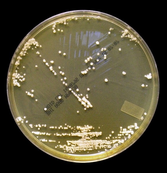 Fun With Microbiology (What's Buggin' You?): Sporothrix schenckii ...