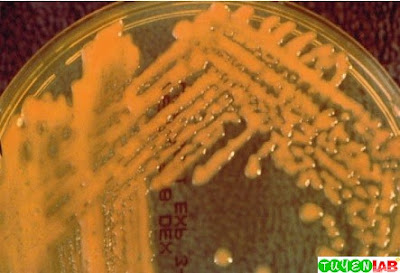 [Microbiology] Atlas of Nonfermenting and Miscellaneous Gram-Negative ...