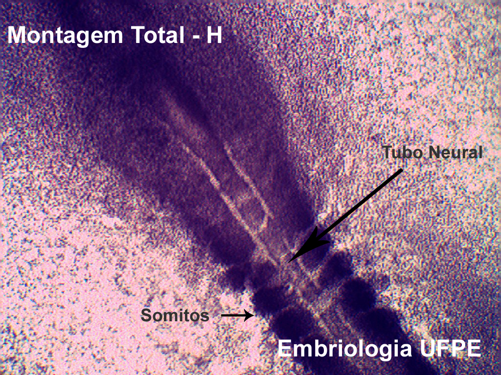 Embriologia UFPE: Gastrulação