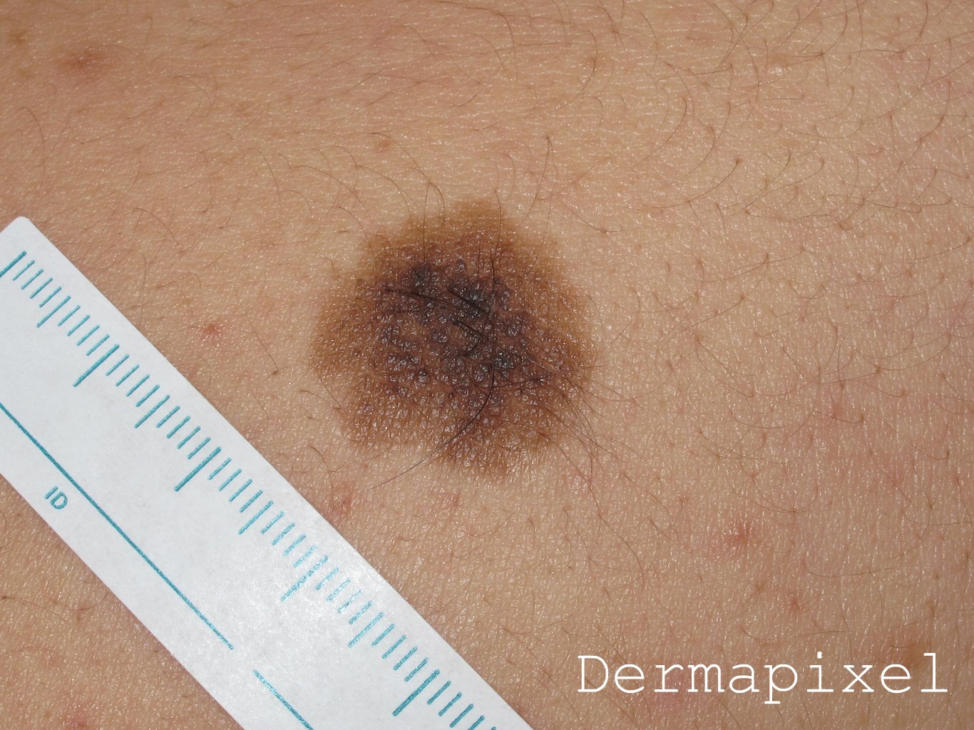 Dermapixel: abril 2013