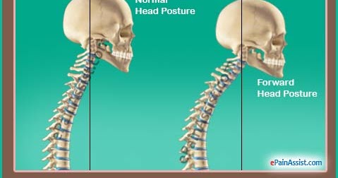 Four Yoga Poses to Help Tight Neck & Shoulders