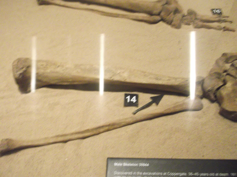 HISTORY OF A BECK: Mesolithic human tibia shaft excavated from the ...