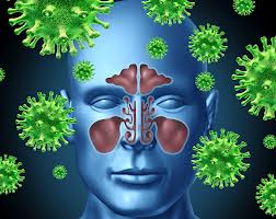 Penyebab Sinusitis Dan Pengobatannya | KUMPULAN TIPS KESEHATAN ...