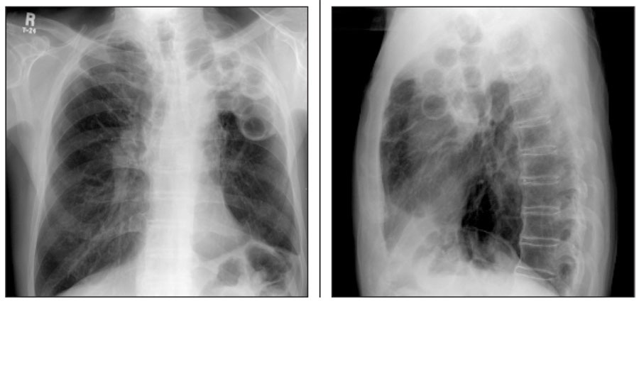 Case of the Day: Old Timer