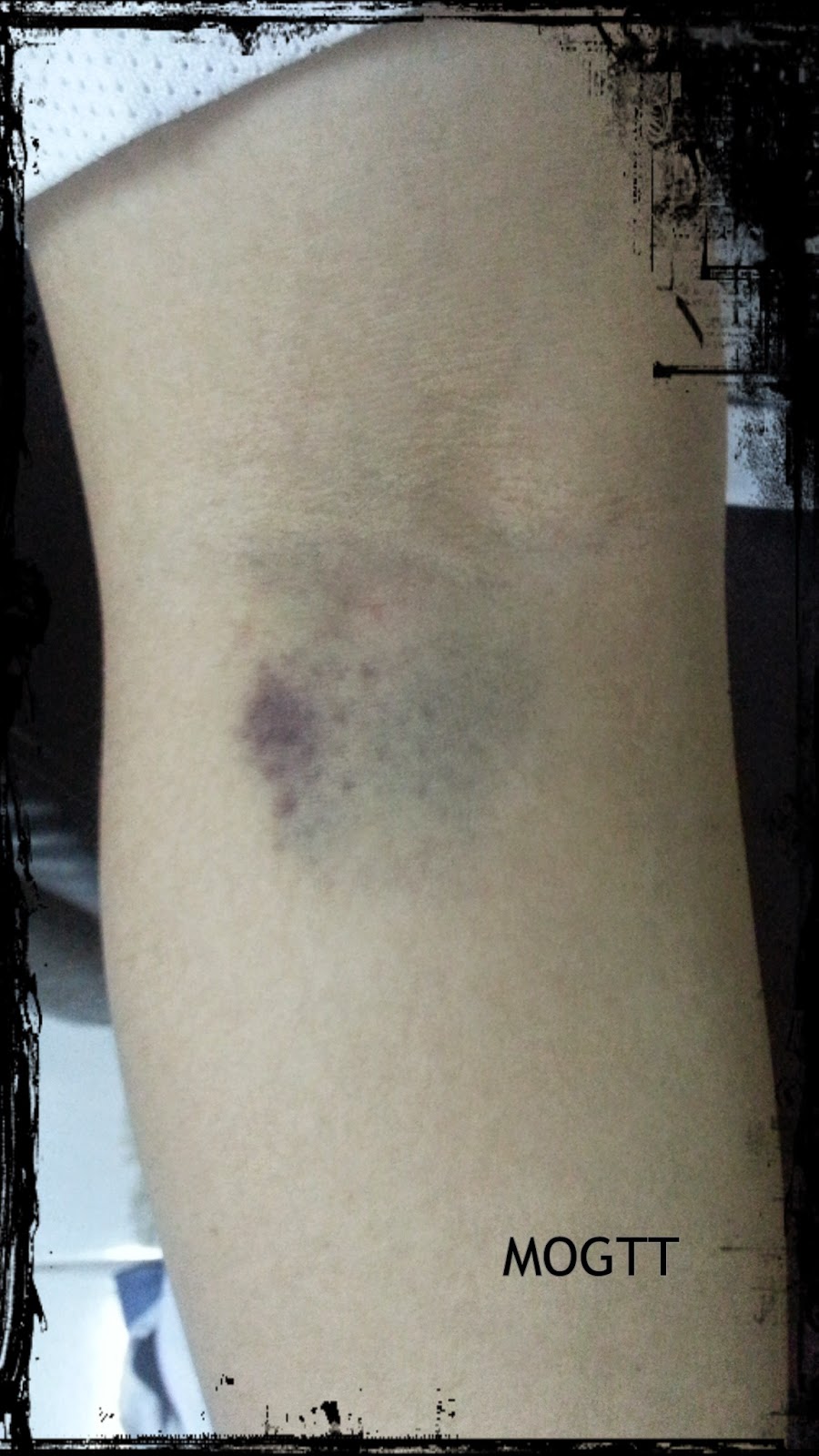 Ujian Air Gula dan Prosedur Yang Perlu Ibu Hamil Tahu |Lemari Vitamin Dang