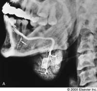 Dentistry and Medicine: Anatomy and Physiology of the Salivary Glands ...