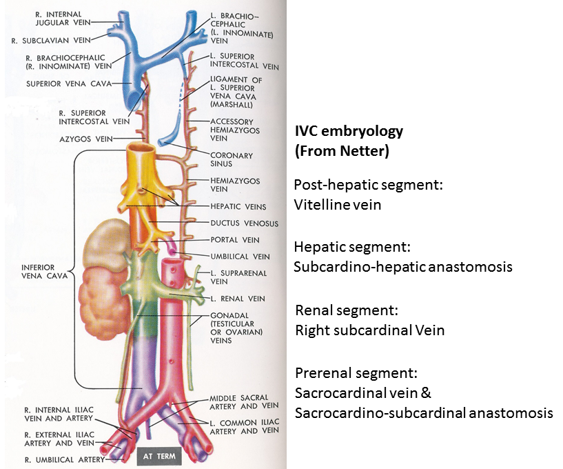 Pedi cardiology: Inferior Vena Cava - Embryology