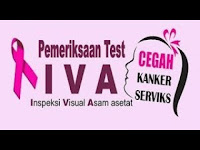 Pemeriksaan IVA Test ~ Asuhan Kebidanan