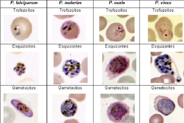 Epidemilogía TOPT S: febrero 2013